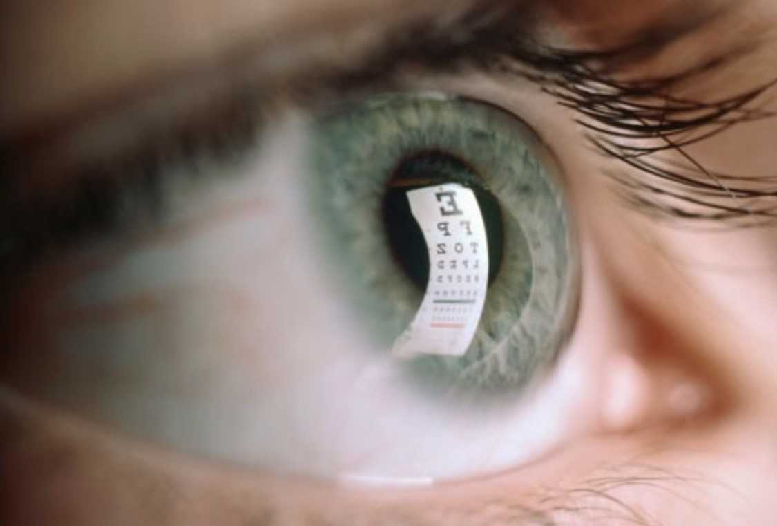 Gas Permeable Lenses Fittings - Visioncare Associates